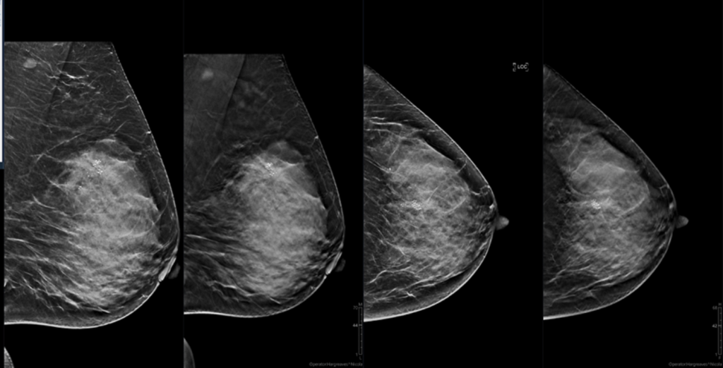 Essentials of Breast Radiology - National Breast Imaging Academy